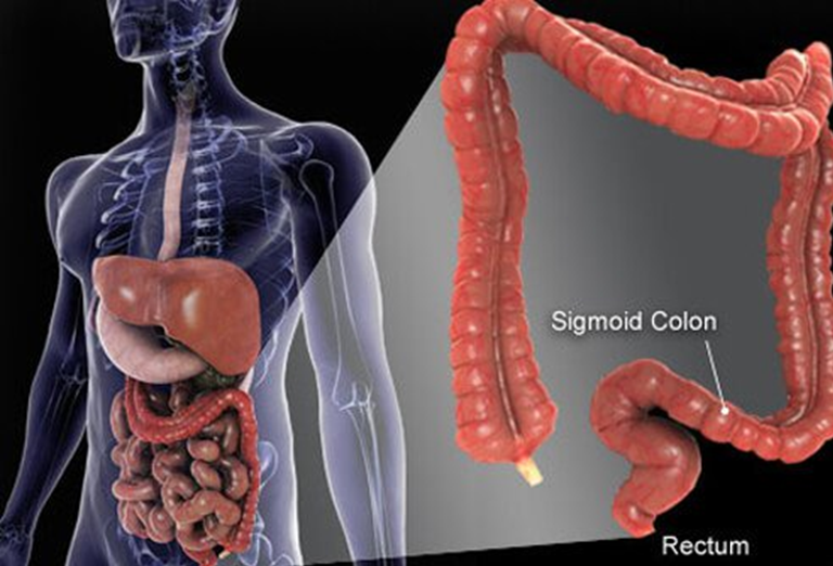 Eating For A Healthy Colon – My Gut Instinct